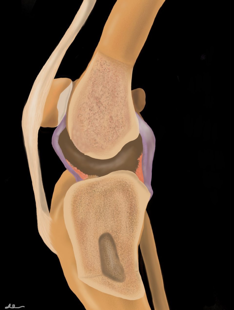 What is the Cranial Cruciate Ligament (CCL)and Why Does it Rupture ...