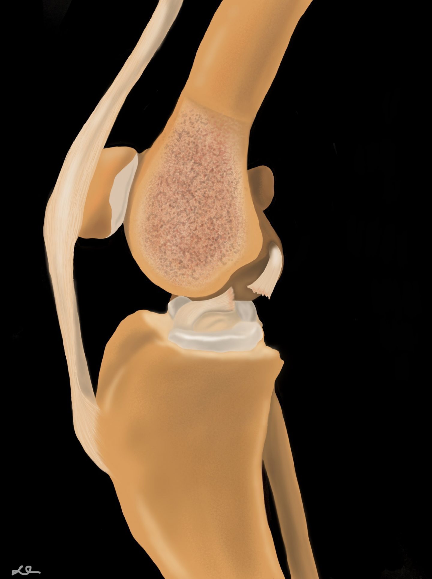 What is the Cranial Cruciate Ligament (CCL)and Why Does it Rupture ...