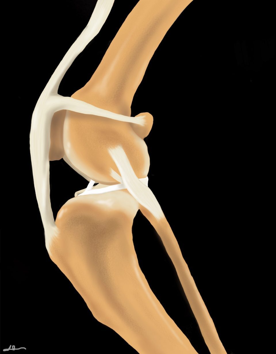 The Role of Surgery for CCL Disease | Canine Arthritis Resources and ...